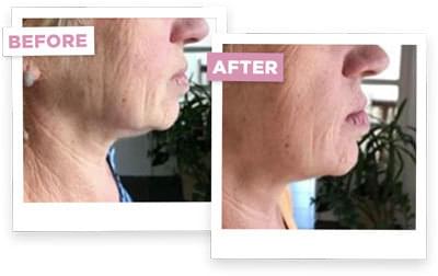 FREEBIE Neck & Jawline | Face Yoga Method